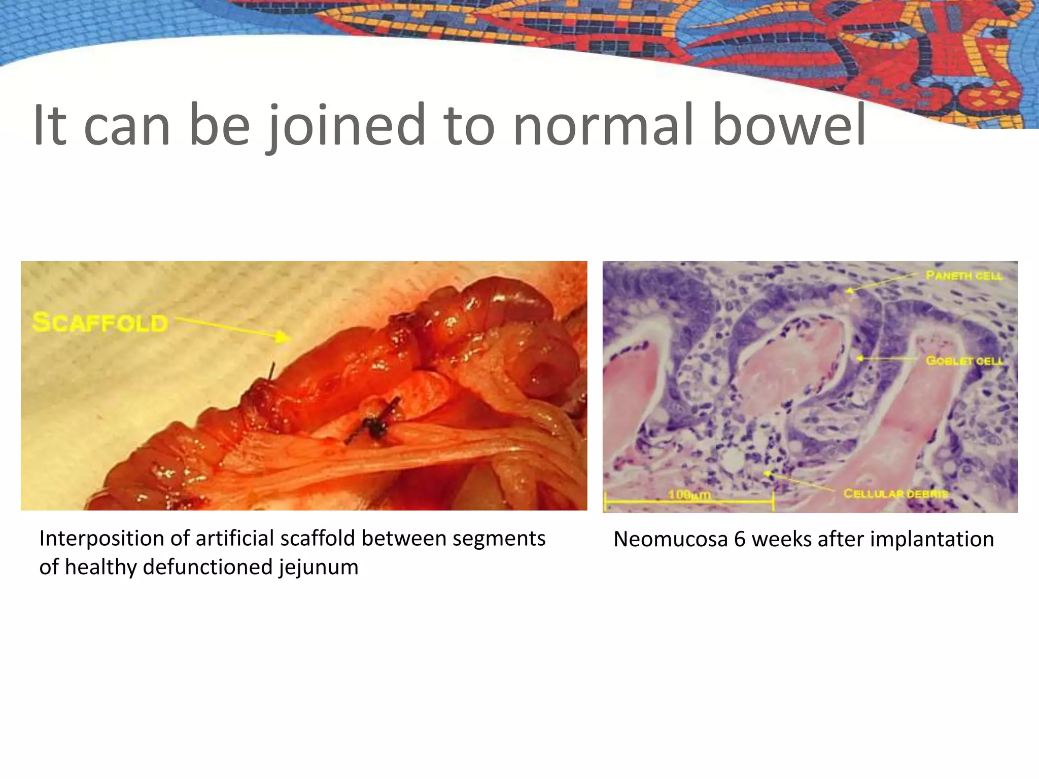 Future Developments in adult Intestinal Failure | PPTX