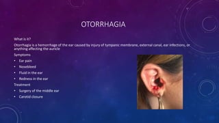 13 h explanation of 10 terms | PPT