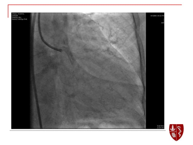 PCI & AimRadial 2018 | FFR in Left Main Disease - William F. Fearon | PPT