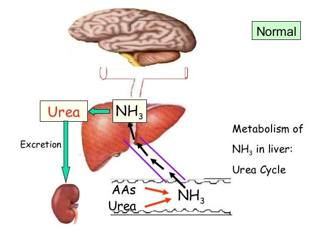 13 hepatic failure