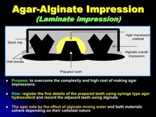 hydrocolloids impression dental material | PPT