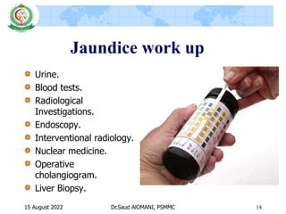 13Jaundice.pptx