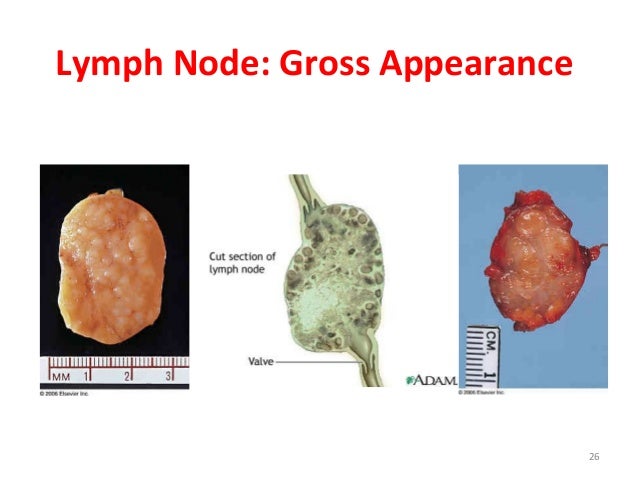 13 lymphoid organs dr kirti 21 dec (2)