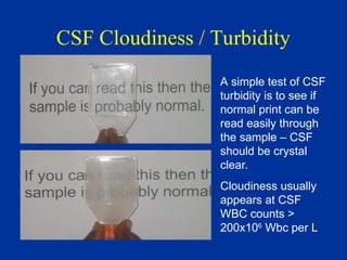 13 Meningitis – Lumbar Puncture for CSF.ppt