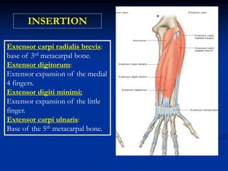 13 ms Forearm.ppt