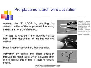 Multifunctional Archwire for Bite Opening /certified fixed orthodontic ...