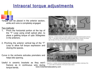 Multifunctional Archwire for Bite Opening /certified fixed orthodontic ...