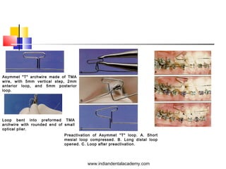Multifunctional Archwire for Bite Opening /certified fixed orthodontic ...