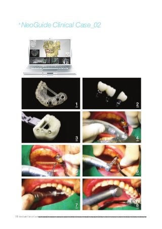Neo guide system_201505_ver04 | PDF