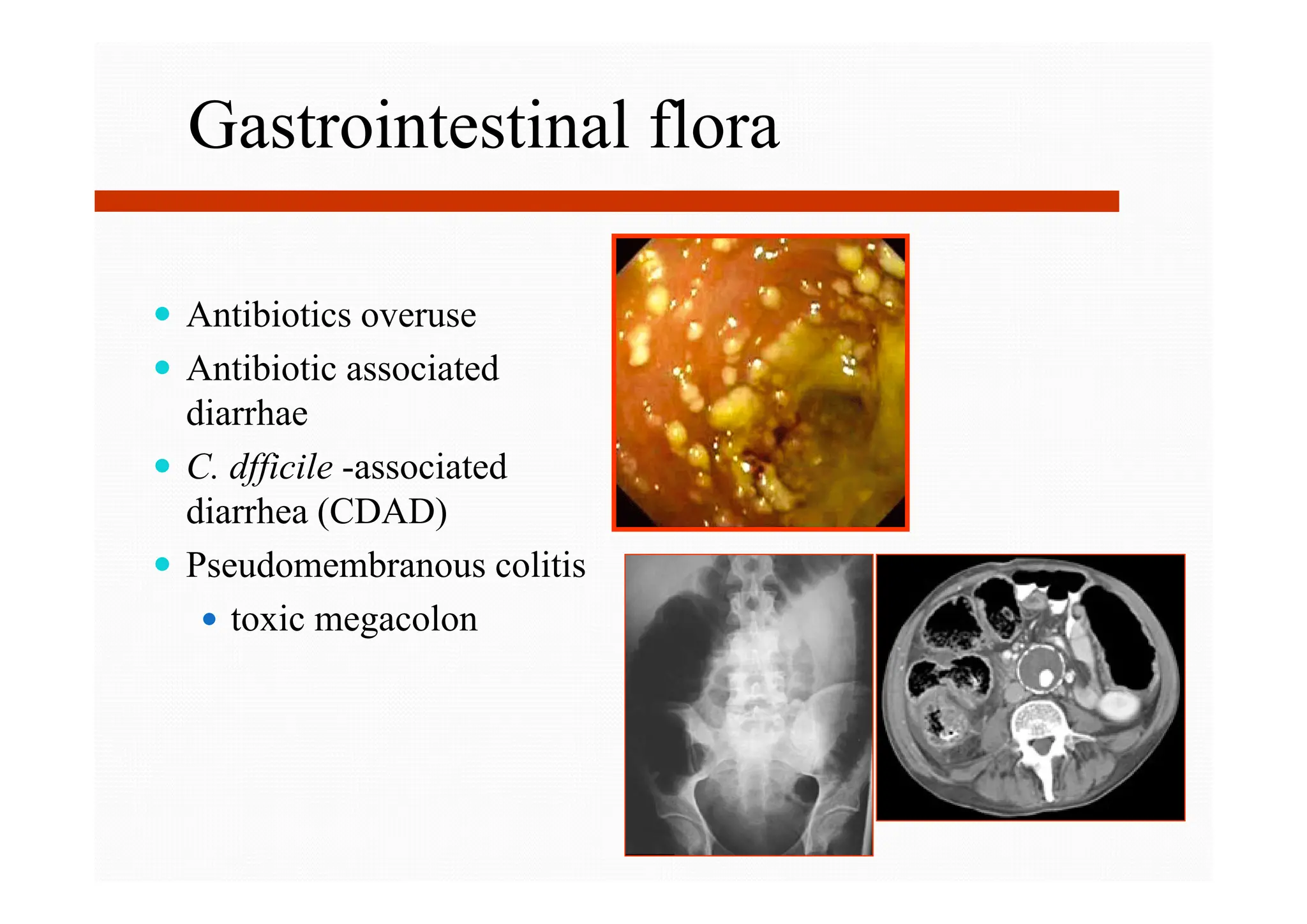 13 Normal flora.pdf for students of microbiology fourth semester | PPT