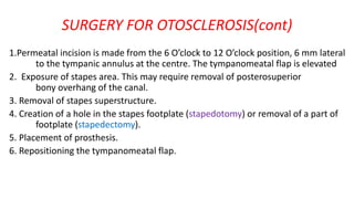 OTOSCLEROSIS | PPTX