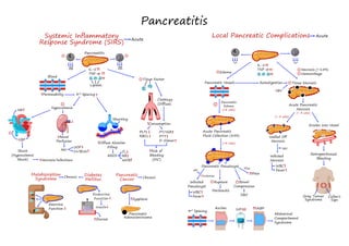 13• Pancreatitis [Illustrations Key].pdf