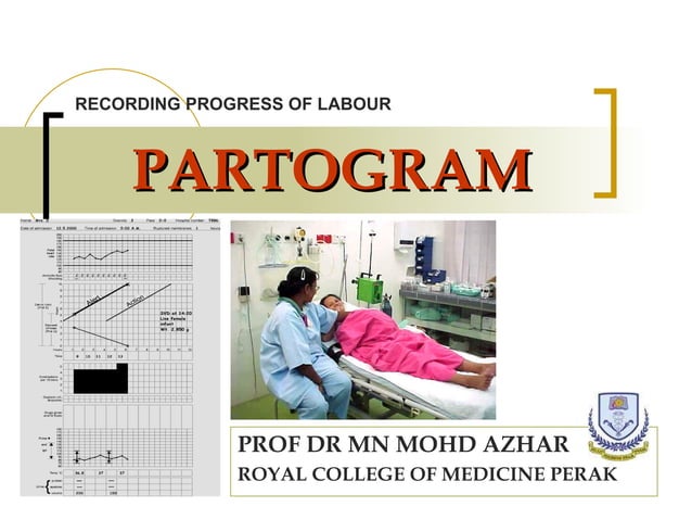 13 partogram | PPT | Pregnancy | Reproductive Health
