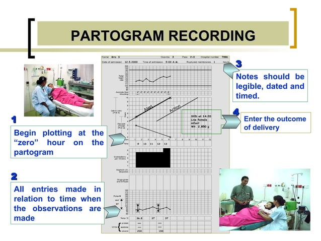 13 partogram | PPT | Pregnancy | Reproductive Health