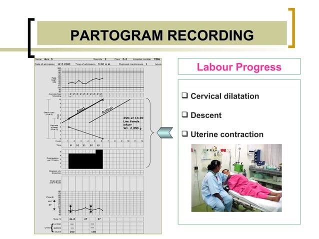 13 partogram | PPT | Pregnancy | Reproductive Health