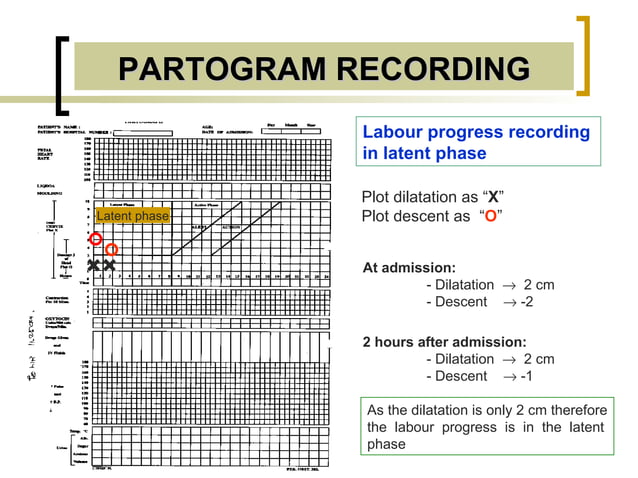 13 partogram | PPT | Pregnancy | Reproductive Health