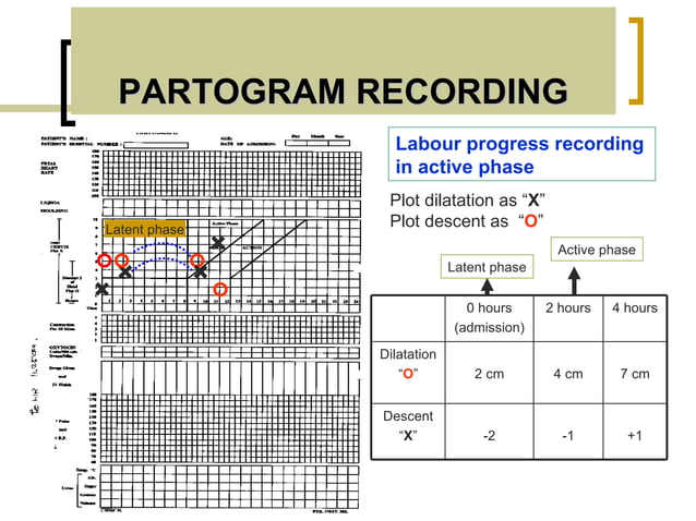 13 partogram | PPT | Pregnancy | Reproductive Health