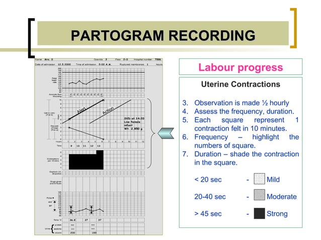 13 partogram | PPT | Pregnancy | Reproductive Health