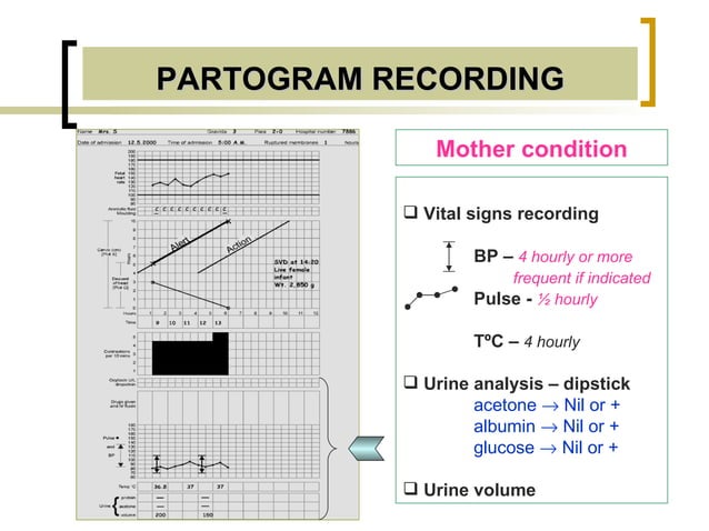 13 partogram | PPT | Pregnancy | Reproductive Health