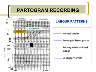 13 partogram | PPT