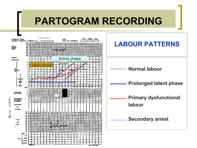 13 partogram | PPT | Pregnancy | Reproductive Health