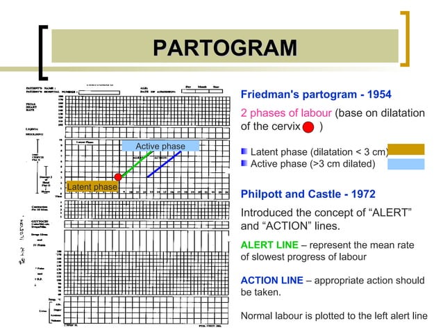 13 partogram | PPT | Pregnancy | Reproductive Health