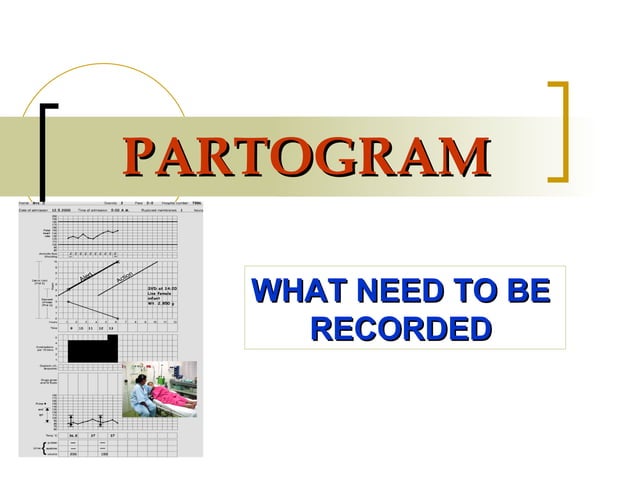 13 partogram | PPT | Pregnancy | Reproductive Health