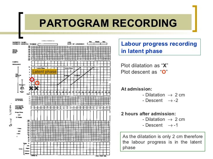 13 partogram