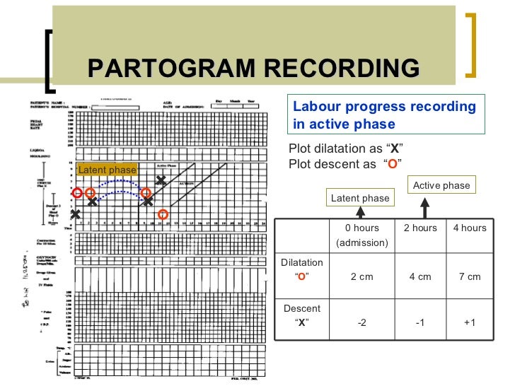 13 partogram