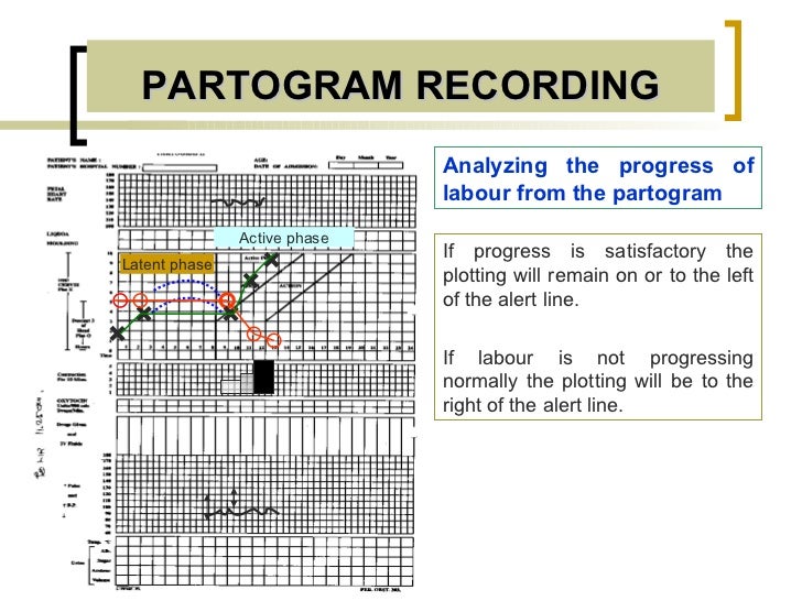 13 partogram