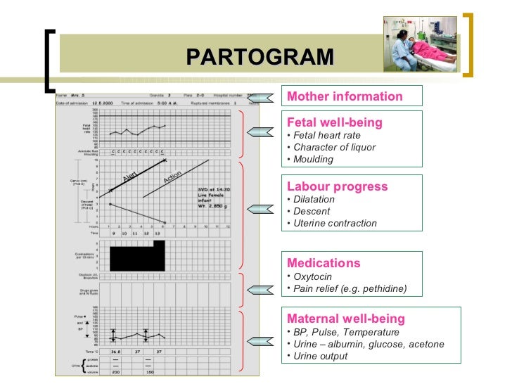 13 partogram