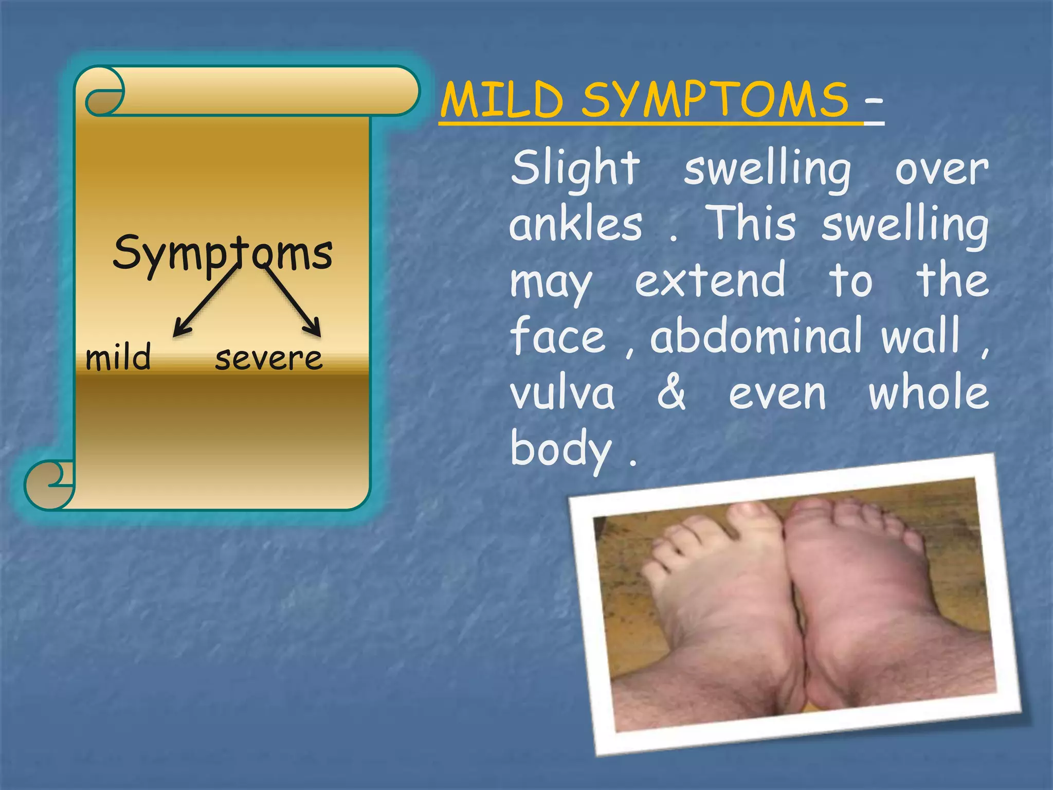 Toxemia of pregnancy: pre-eclampsia | PPTX
