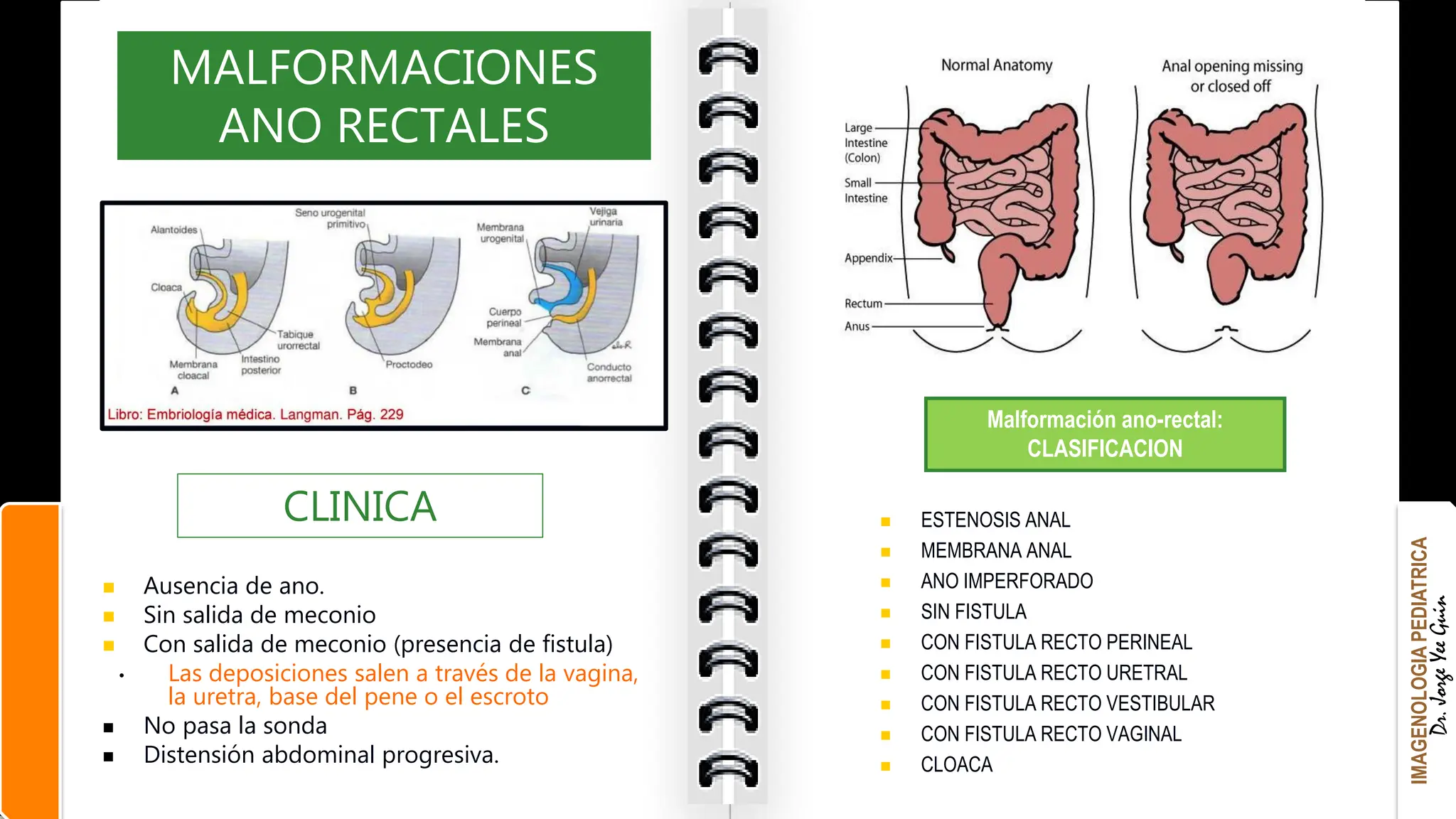 Malformaciones Anorectales desde la imagenologia.pdf