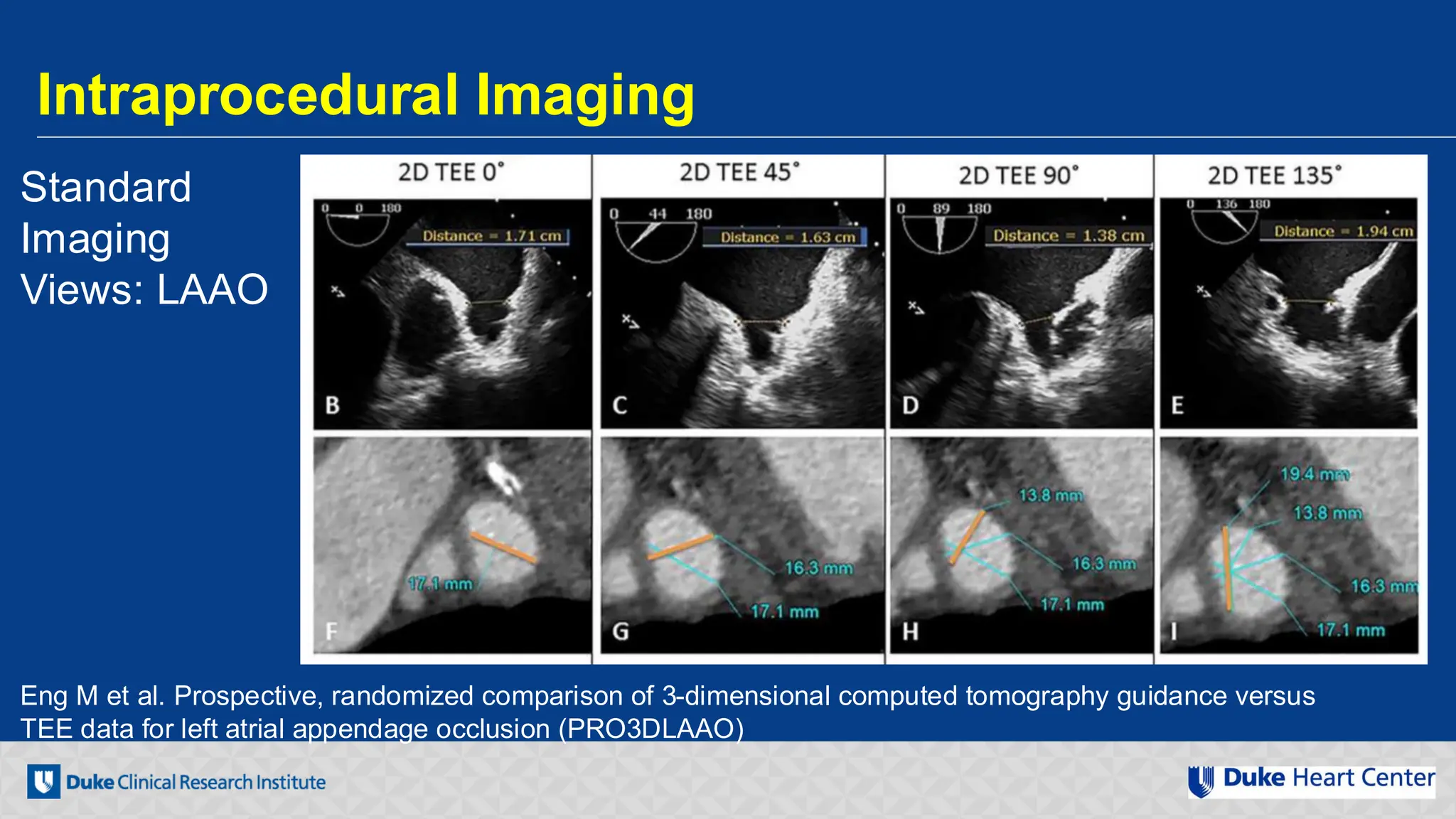 Echocardiography for Structural Heart Disease Interventions | PDF