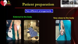 13 Sciahbasi aimradial20170921 RAD-MATRIX study | PPTX