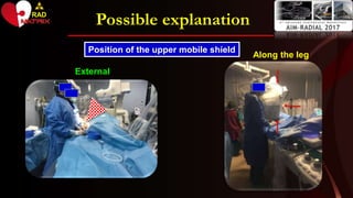 13 Sciahbasi aimradial20170921 RAD-MATRIX study | PPTX