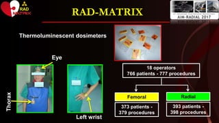 13 Sciahbasi aimradial20170921 RAD-MATRIX study | PPT