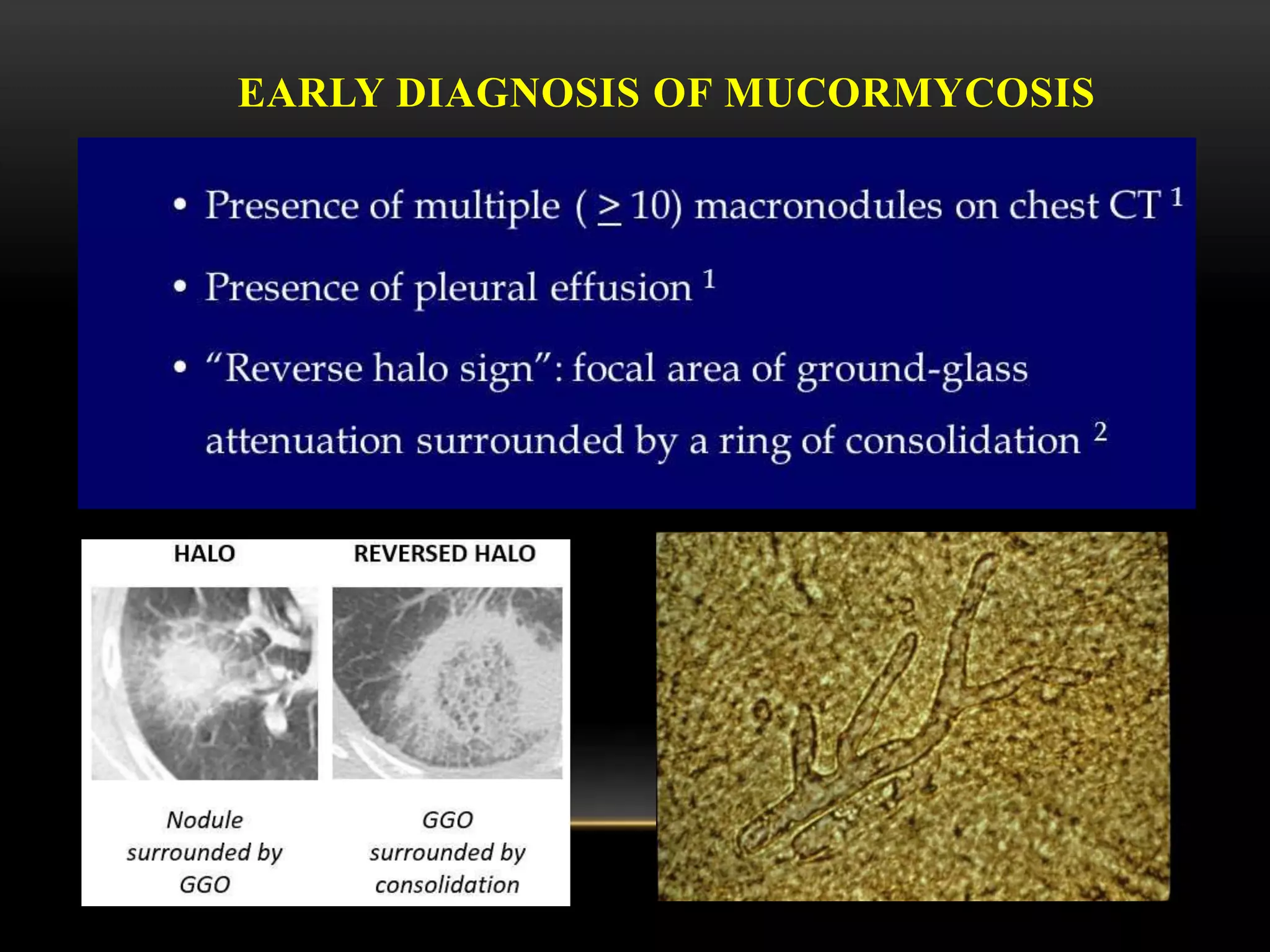 Destructive lesions of palate | PPTX