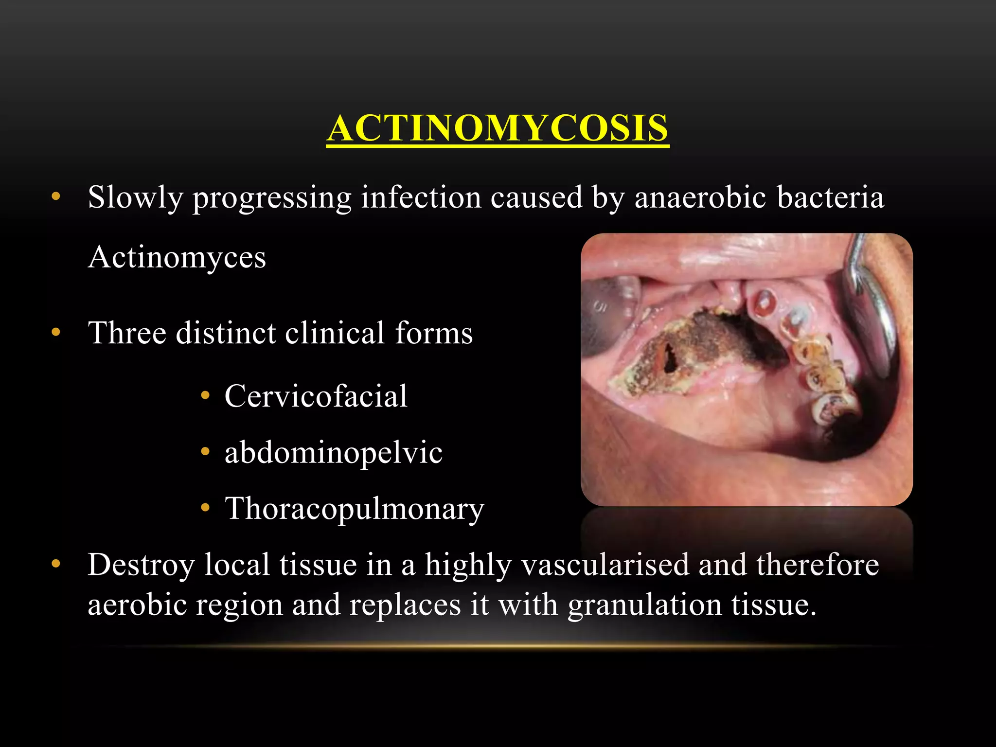 Destructive lesions of palate | PPTX