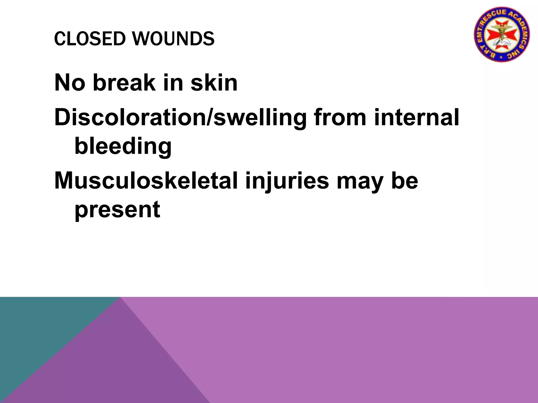 13 soft tissue_injuries | PPT