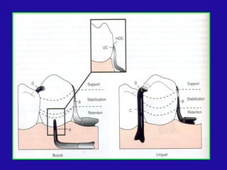 support for distal extension partial denture | PPT | Dental Health ...
