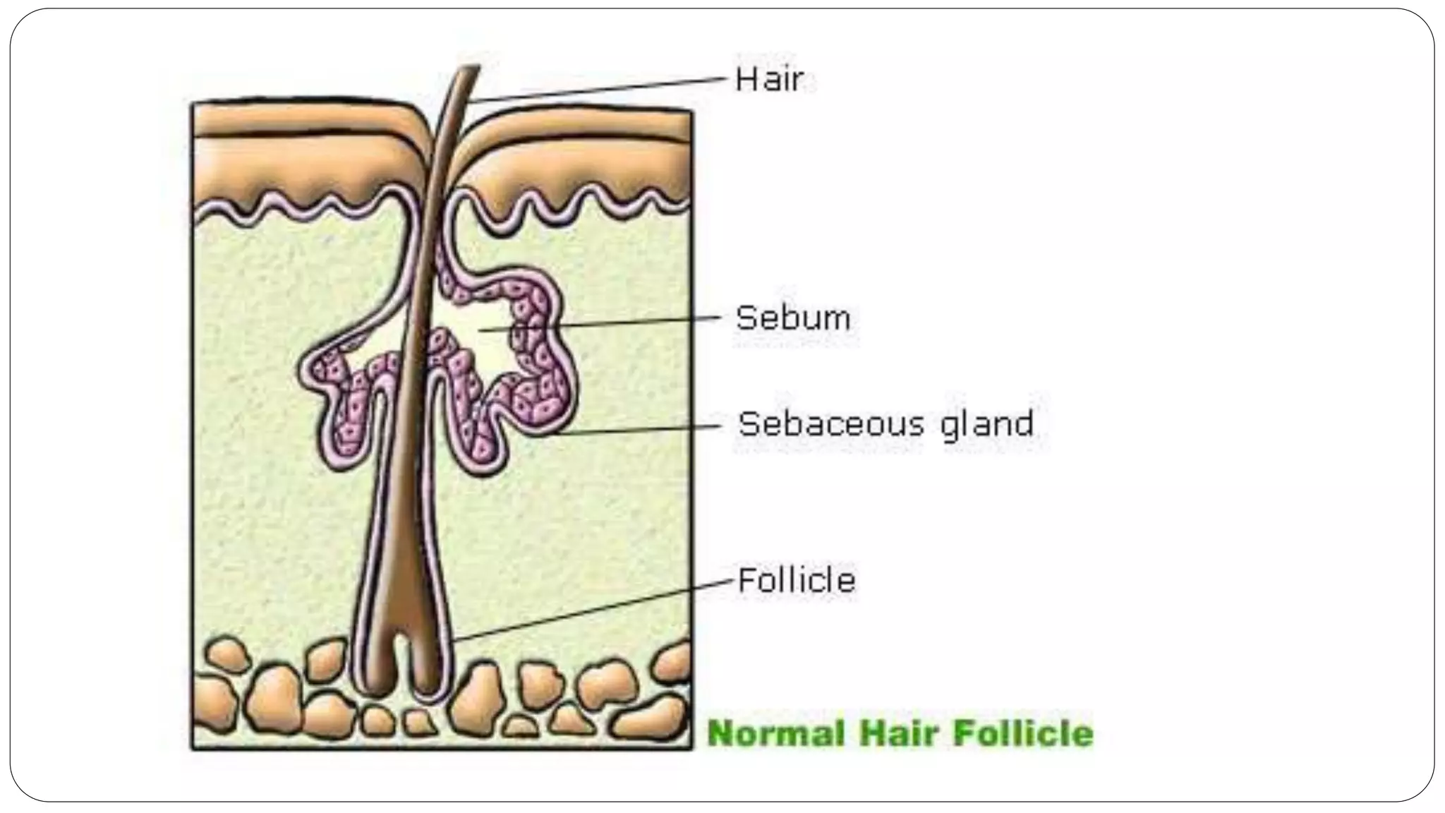 13 Surgical Infections of the Skin and Subcutaneous Tissues.pptx