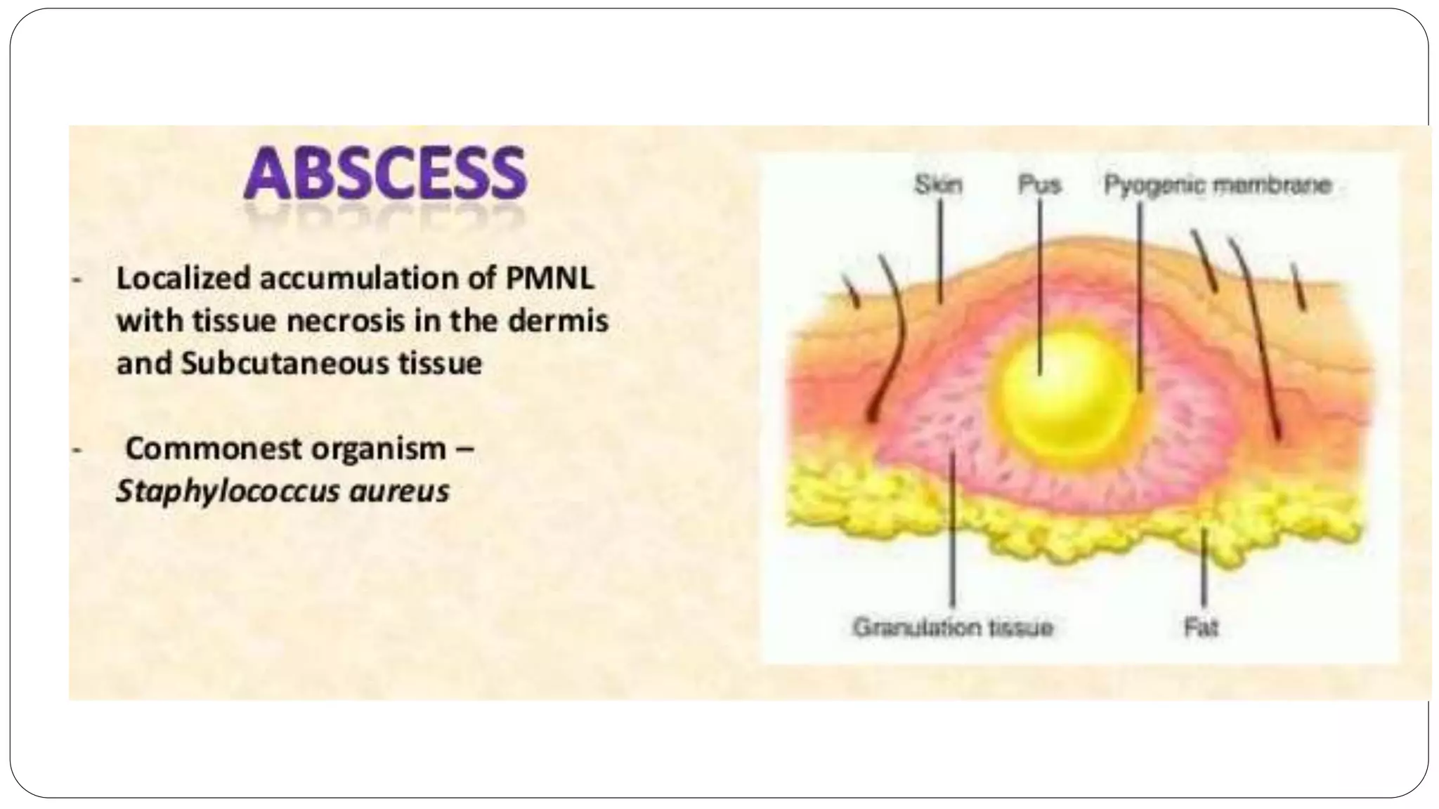 13 Surgical Infections of the Skin and Subcutaneous Tissues.pptx
