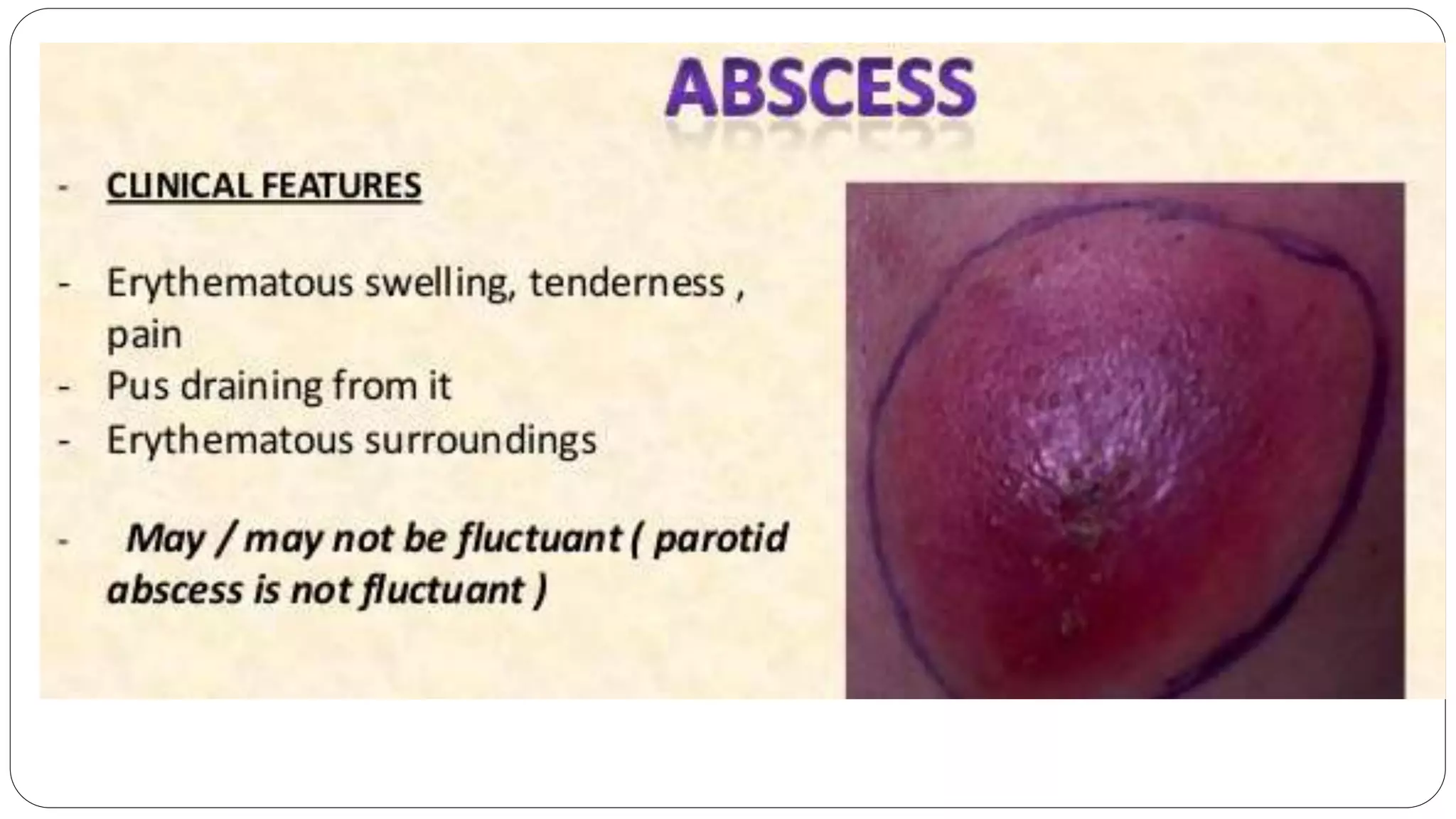 13 Surgical Infections of the Skin and Subcutaneous Tissues.pptx