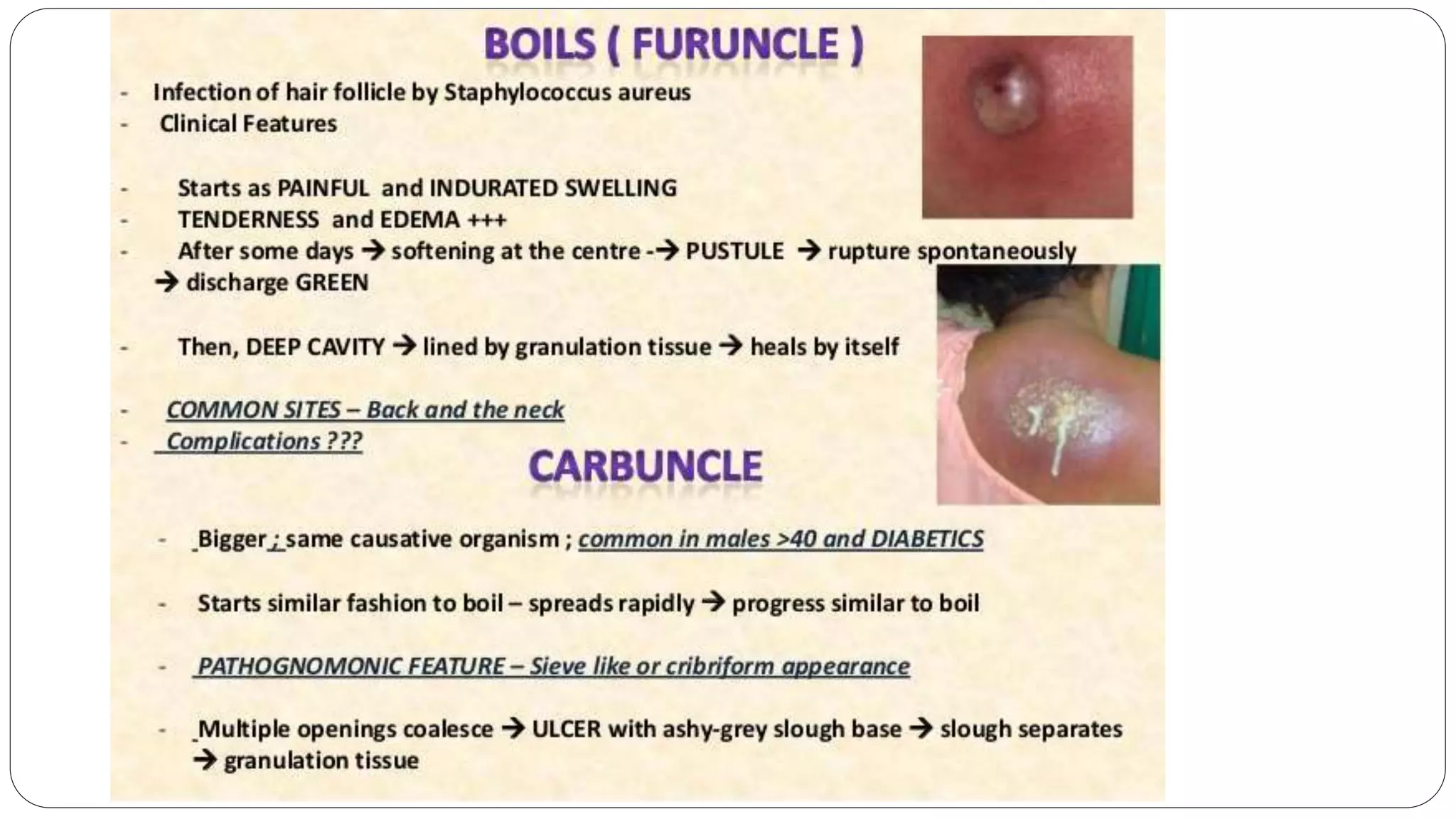 13 Surgical Infections of the Skin and Subcutaneous Tissues.pptx