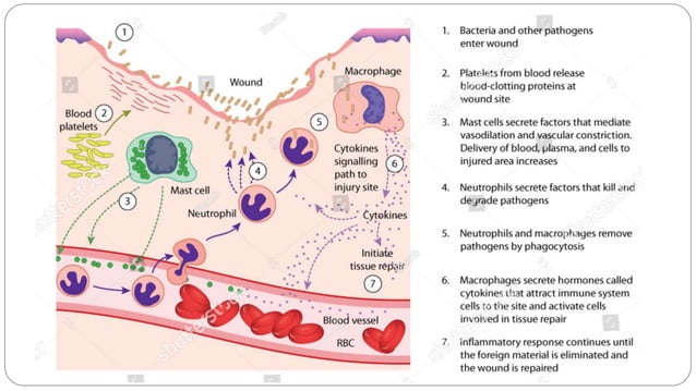 13 Surgical Infections of the Skin and Subcutaneous Tissues.pptx | Skin ...