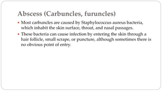 13 Surgical Infections of the Skin and Subcutaneous Tissues.pptx