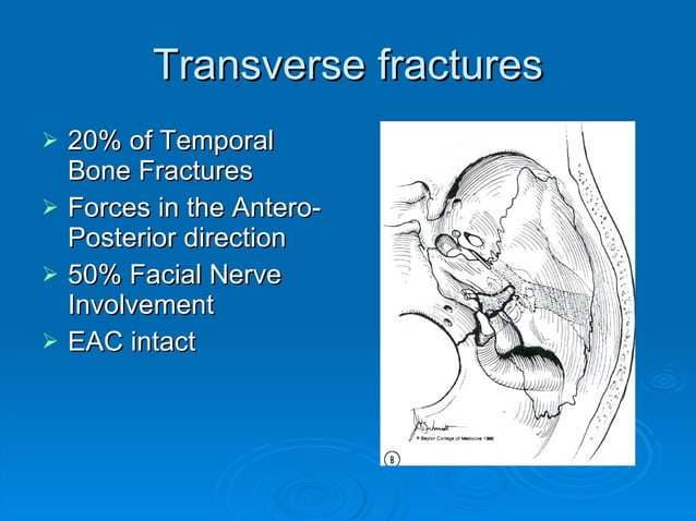 13temporalbonetrauma-100415230612-phpapp01-5.pdf