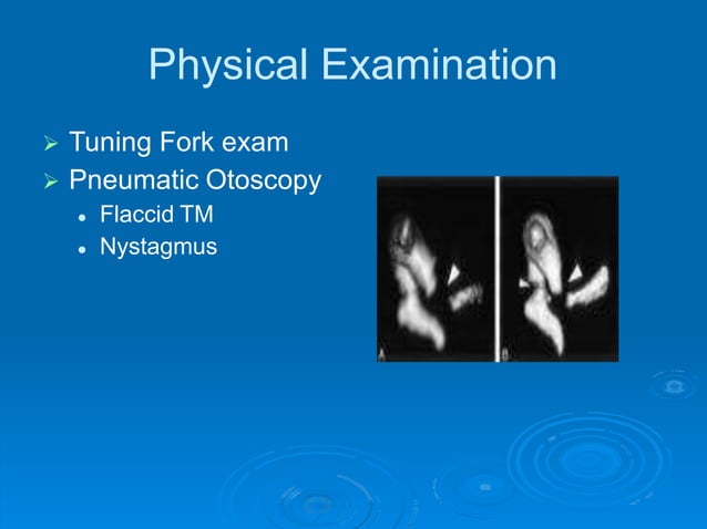 13temporalbonetrauma-100415230612-phpapp01-5(1).pptx