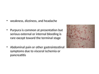 13,,,,Thrombotic thrombocytopenic Purpura (TTP) and Hemolytic-uremic.pptx
